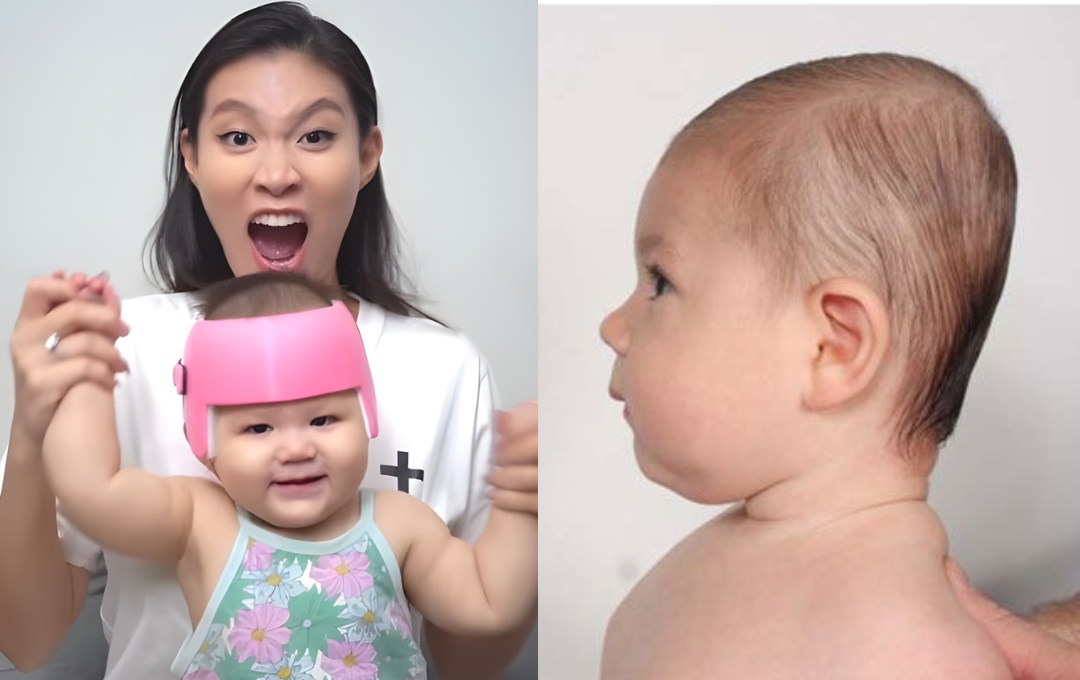Tips Mencegah Kepala Peyang pada Bayi! - LIPUTAN JATIM